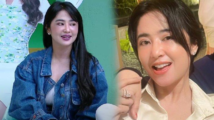 FOTO-FOTO Dewi Perssik Setelah Operasi Makin Beda Dari Aslinya, Benarkah Makin Cantik dan Awet ...