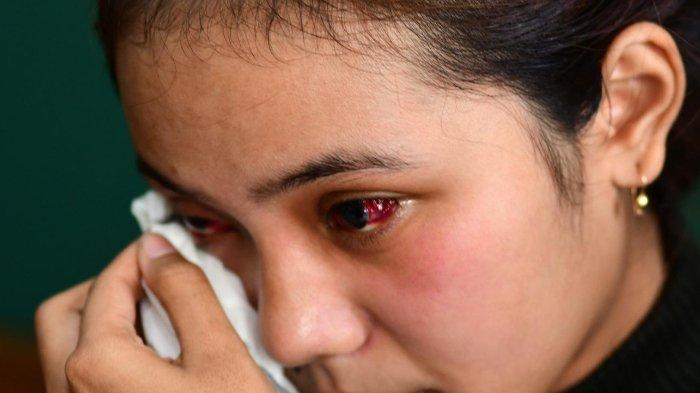 Kisah Kevia Naswa, Aremanita Saksi Hidup Tragedi Kanjuruhan, Kena Gas ...