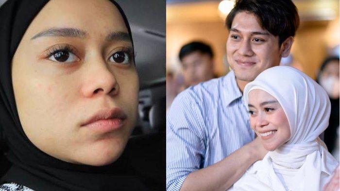 Kondisi Lesti Kejora Jadi Korban KDRT Rizky Billar: Dirawat di Rumah Sakit, Kuasa Hukum Minta ...
