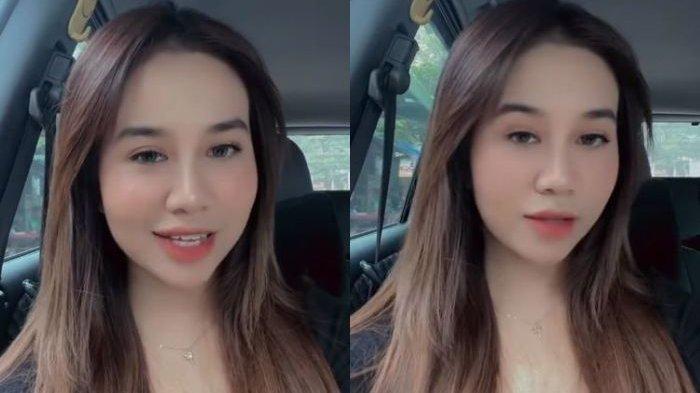 Wajah Mayang Dipuji Makin Glowing Berkat Oplas, Adik Vannessa Angel Kian Moncer Ngartis: Aku ...