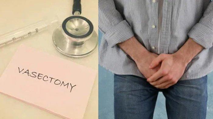 Mengenal Prosedur Vasektomi, Wacana Program Dedi Mulyadi yang Timbulkan ...