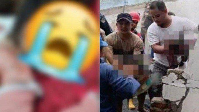 Rintihan Anak Siska Amelia Tubuh Dibalut Perban Karena Kebakaran, Sebut Nama Adiknya yang ...