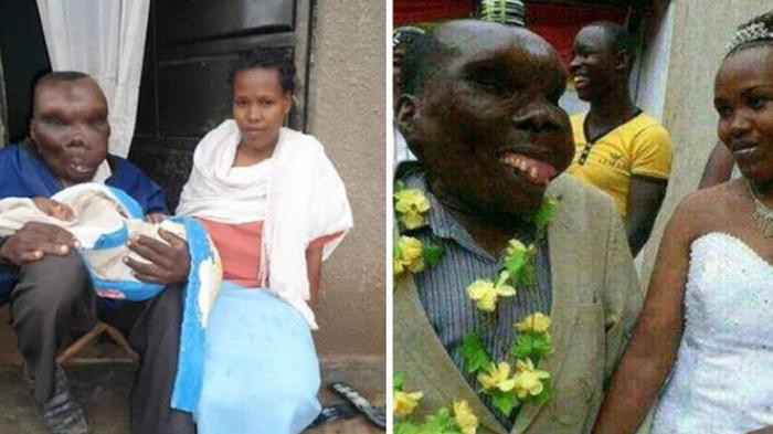 Baguma dan Namanda, Kisah Nyata 'Beauty and The Beast' dari Afrika ...