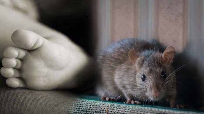Bayi Digigit Tikus Saat Tertidur Bikin Geger Warga Bogor, Kondisinya ...