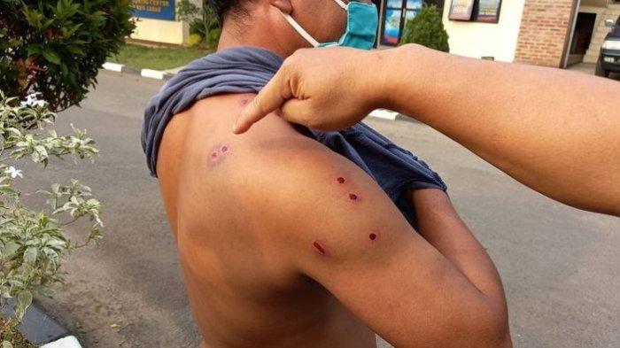 Kebal Senjata Api, Sopir Taksi Online Ditembak 10 Kali Masih Hidup, Komplotan Begal Dibikin ...