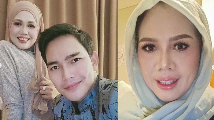 Foto Elly Sugigi Before-After Pakai Behel Gigi Bikin Pangling, Pantas ...