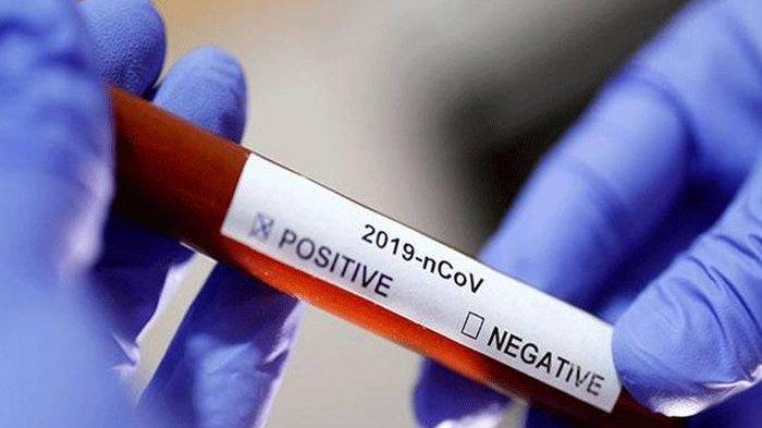 Rahasia di Balik Formula Obat Covid-19 Unair Dibuka, Sudah Diuji Pada ...