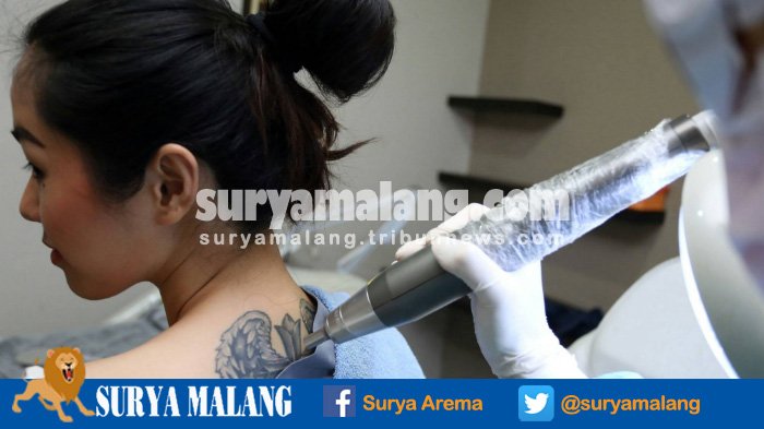 Cara Mudah Menghapus Kenangan Sang Mantan pada Tato, Datang Saja ke ...