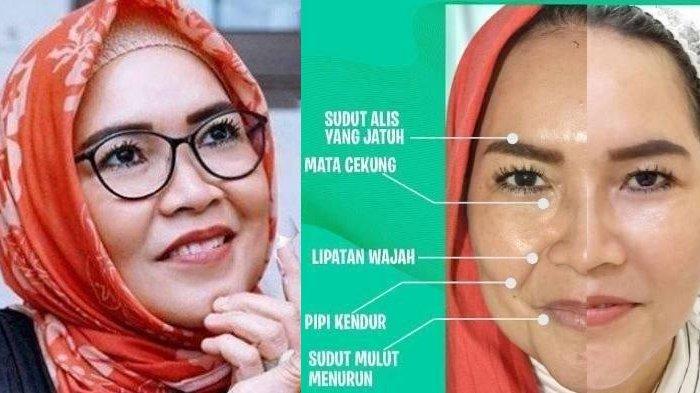 Perubahan Wajah Umi Kalsum Sebelum dan Sesudah Dipermak, Kini Dagu Ibu Ayu Ting Ting Lebih ...