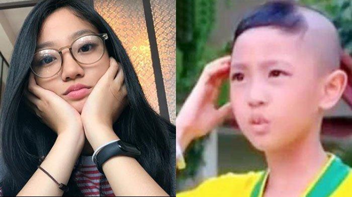 Transformasi Pemeran Ronaldowati Dulu Berambut Botak & Berjambul, Kini ...