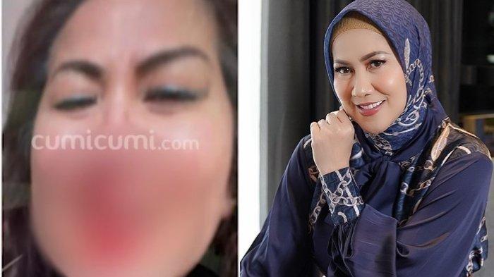 Venna Melinda Alami KDRT saat Nginap di Kota Kediri, Barang Bukti Handuk dan Baju Berdarah ...