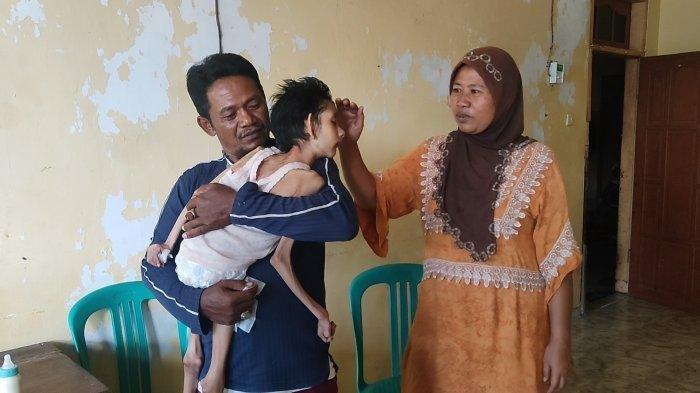 Wanita di Indramayu Alami Penyakit Langka, Usia 15 Tahun Bobotnya Cuma ...