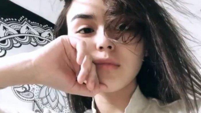 Kabar Duka, Selebgram Laura Anna Meninggal Dunia, Sempat Lumpuh karena ...