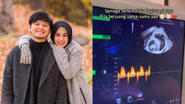 4 Tahun Menanti hingga 3 Kali Gagal Hamil, Anisa Eks Cherrybelle Akhirnya Dikaruniai Anak ...