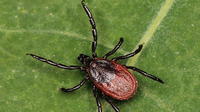 Betisnya Digigit Serangga, Wanita 68 Tahun Harus Operasi 60 Kali hingga ...