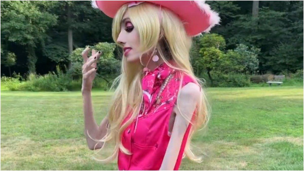 Wanita Super Kurus Ini Ternyata Selebgram, Pilu Dihujat Gegara Badan ...