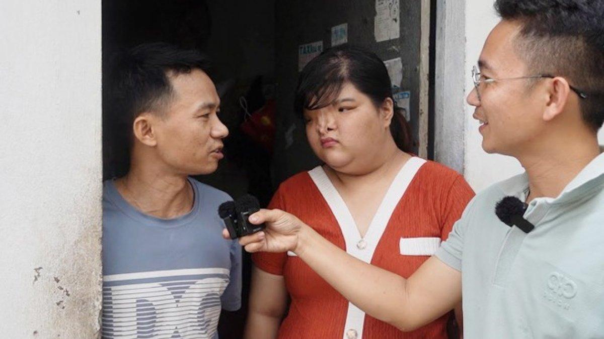 Cinta Tak Pandang Fisik Pria Nikahi Wanita Tanpa Tulang Hidung Awal