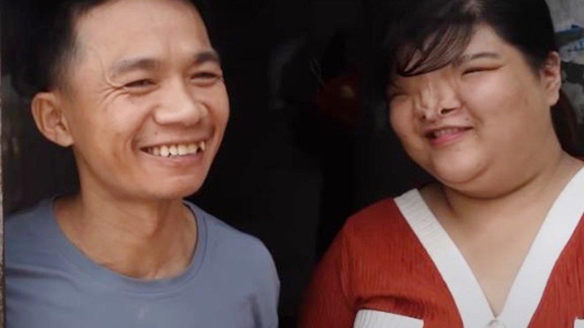 Cinta Tak Pandang Fisik Pria Nikahi Wanita Tanpa Tulang Hidung Awal