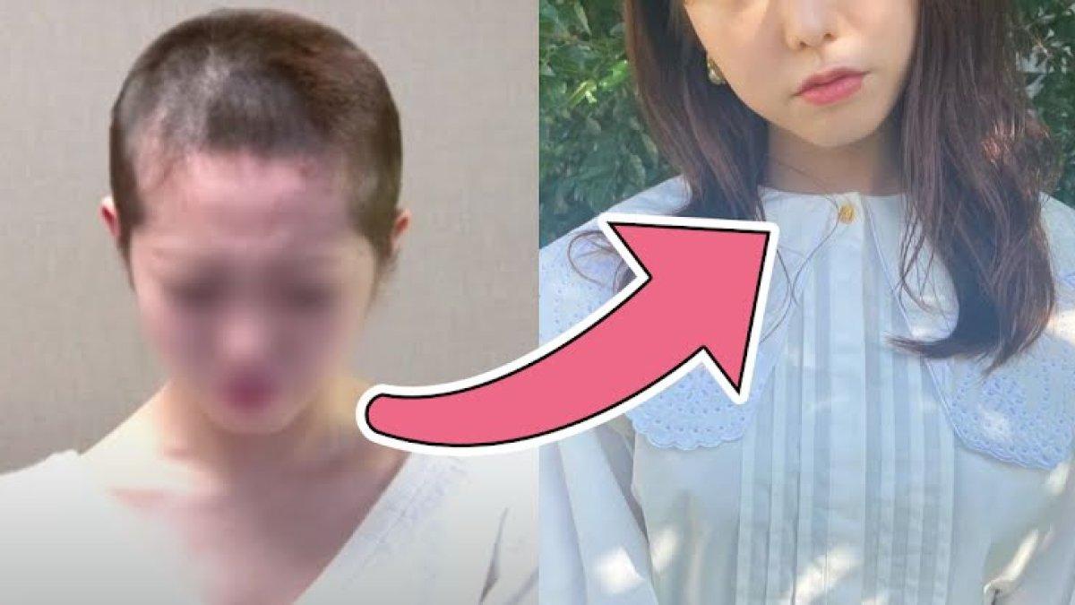 Kepergok Pacaran, Penyanyi Ini Dulu Dihujat Fans, Nekat Cukur Botak ...