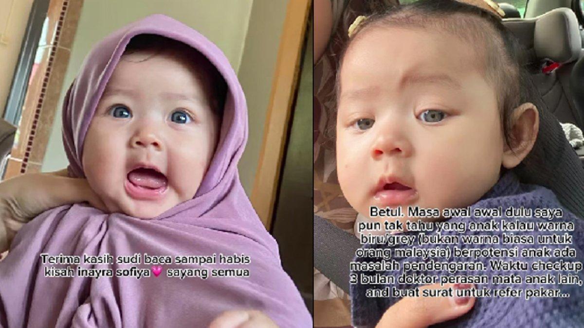 Bayi Barbie! Ibu Heran Anak Bukan Keturunan Bule tapi Bermata Biru ...