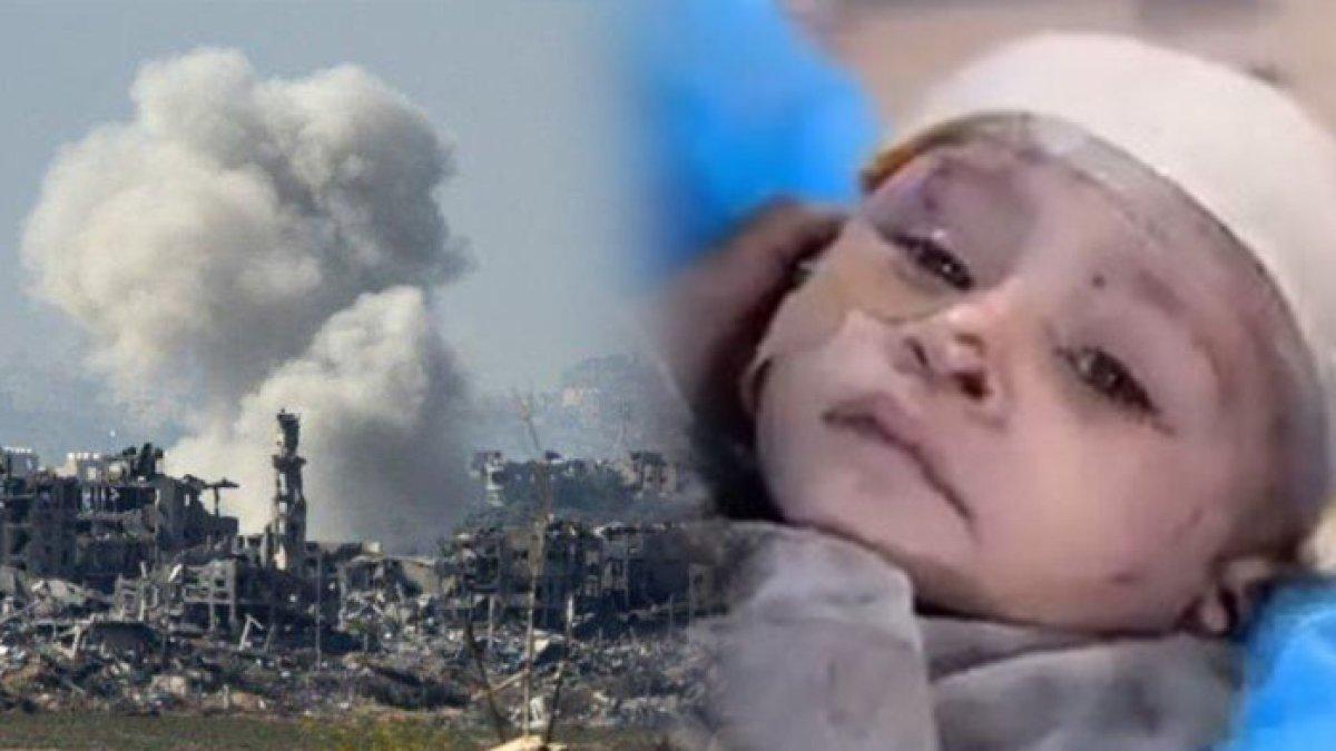 Noor Ahmed Bayi 6 Bulan dari Gaza, Selamat setelah 3 Kali Kena Bom ...