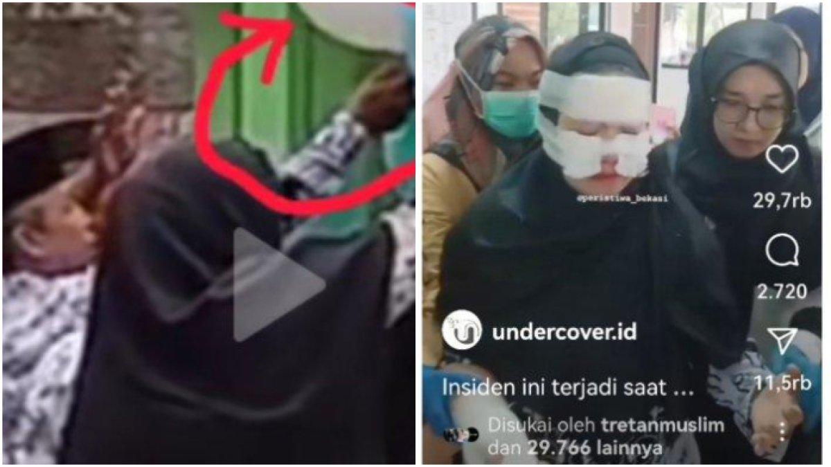 SOSOK Pria Penyala Korek Api Bikin Balon Gas Meledak di Hari Guru, 2 Guru Pilu Wajahnya Diperban ...