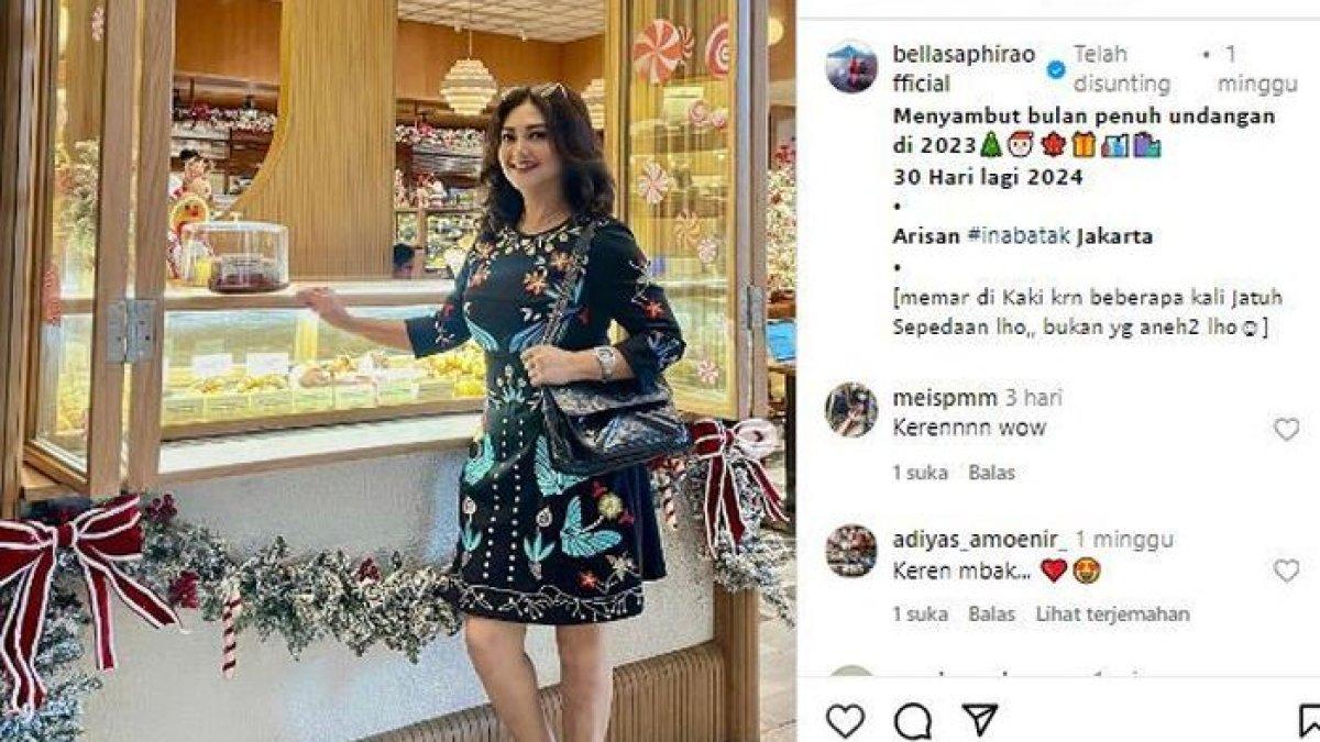 Kaki Lebam-lebam, Bella Saphira Sontak Klarifikasi di Unggahan Fotonya ...