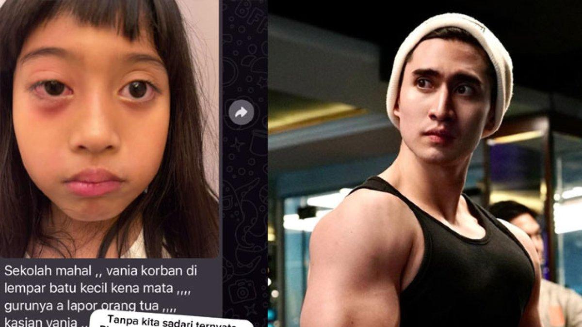 PILU Anak Artis Di-bully di Sekolah, Mata Lebam Dilempar Batu, Kakak Murka: Hah Siapa yang ...