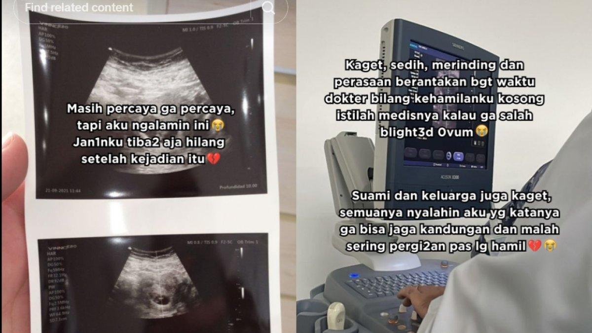 Wanita Curhat Janin Dalam Rahim Hilang Setelah Bertemu Nenek-nenek ...