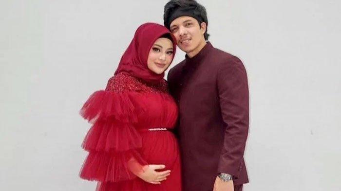 Pakai Pilis di Dahi, Aurel Hermansyah Dipuji karena Penurut, Atta ...