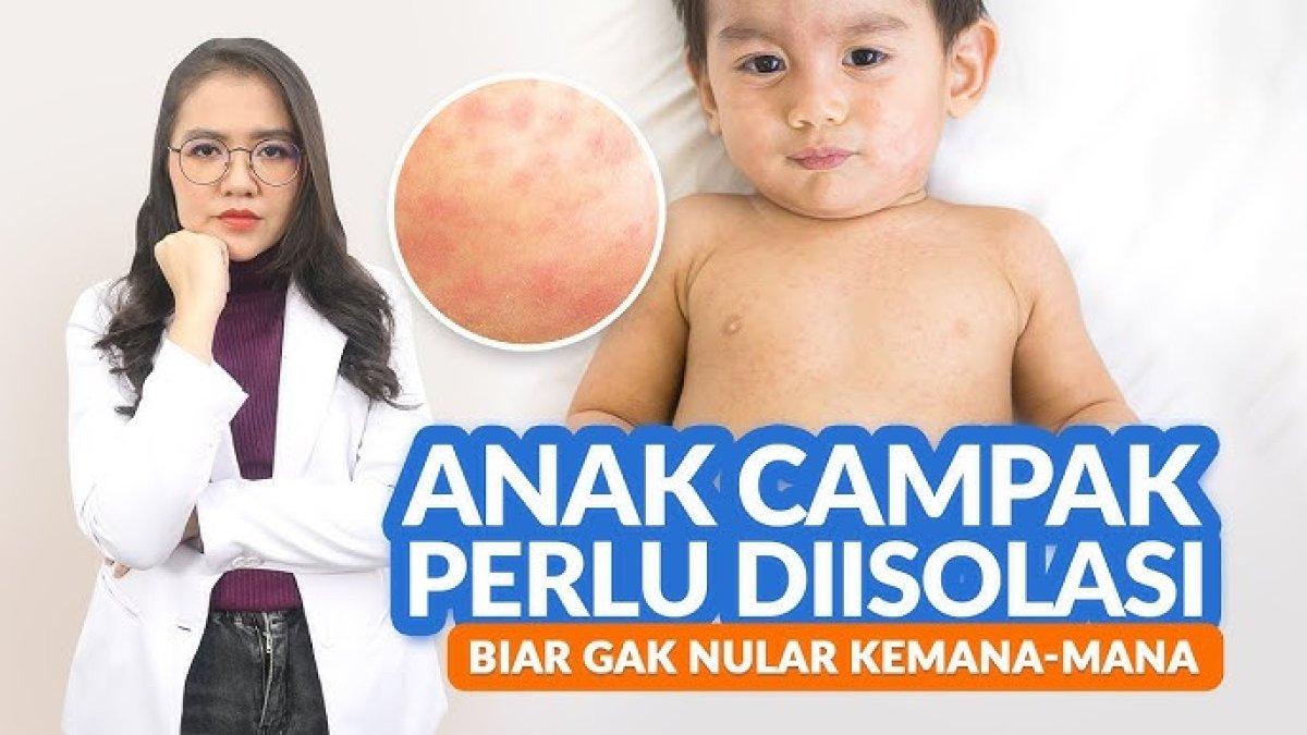 5 Cara Mengobati Campak Anak Dirumah Minum Banyak Cairan, Kontrol Demam ...