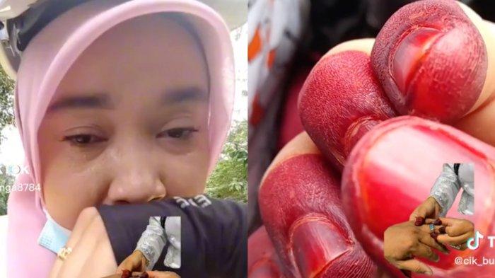 Inai Masih di Jari, Istri Pilu Suami Meninggal 26 Hari Setelah Akad ... Inai Masih di Jari, Istri Pilu Suami Meninggal 26 Hari Setelah Akad ...
