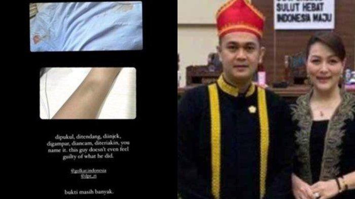 DULU Selingkuh Kepergok Istri, Kini James Arthur Kojongian Kembali ...