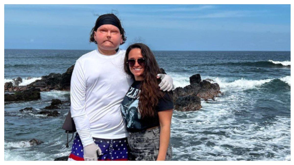 Cinta Tanpa Pandang Fisik, Wanita Ini Terima Lamaran dari Pria yang ...