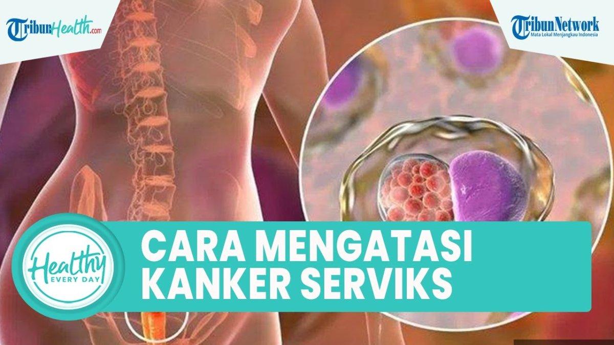 5 Cara Mengobati Kanker Serviks Operasi, Kemoterapi, Terapi Radiasi ...