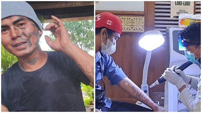 Dulu Ikut-ikutan Penuhi Tubuh dengan Tato, Bimo Kini Idap Meningitis ...