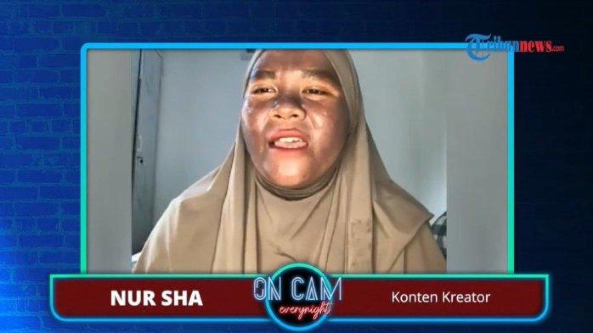 'Awalnya Putih' Curhat Nur Sha, Wajah Gosong Imbas Krim Mengandung Merkuri, Didiganosis ...