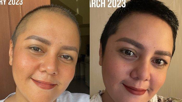 Cinta Ramlan Adik Olla Ramlan Mati Suri 3 Jam saat Operasi Kanker ...