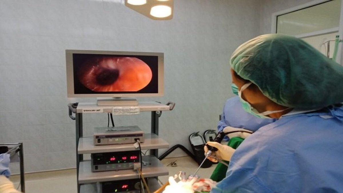 5 Cara Mengobati Kanker Hati Pemotongan, Transplantasi, Dijamin Sembuh ...