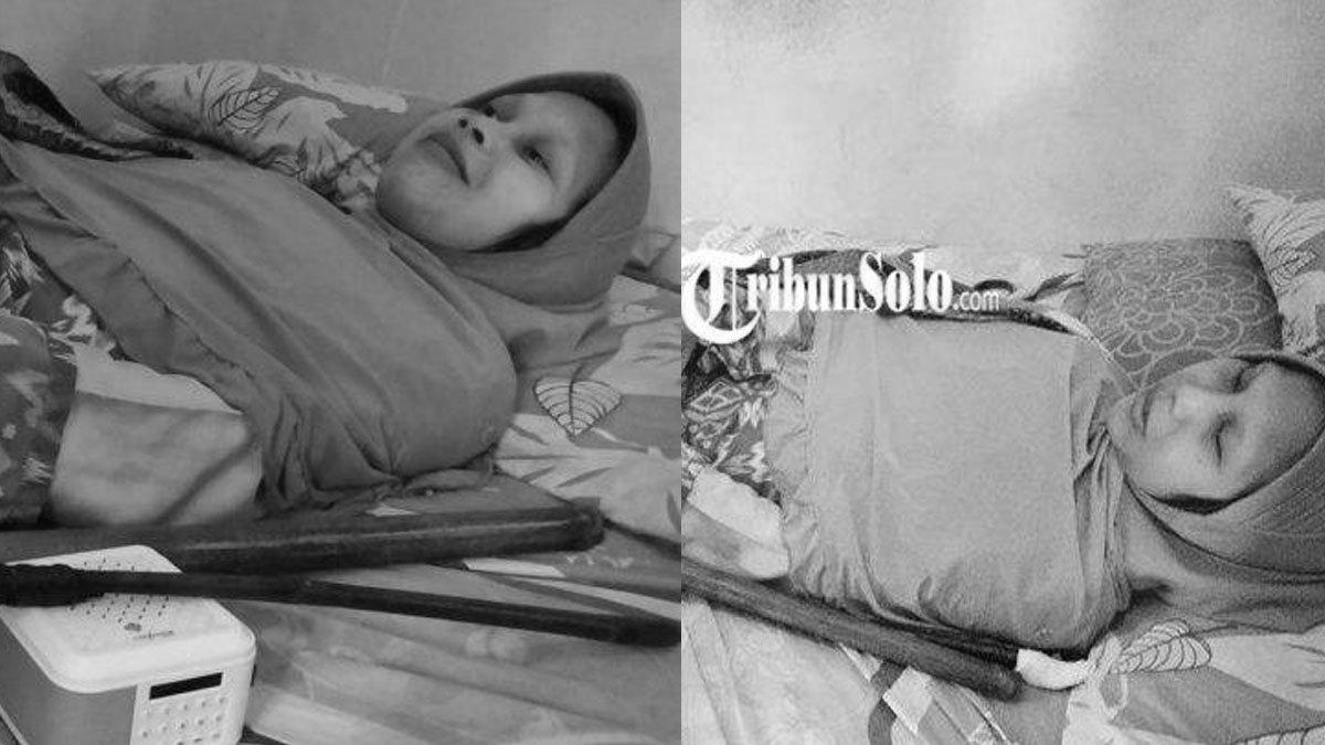 Innalillahi! Sulami Si Manusia Kayu Asal Sragen Meninggal, Keluarga ...