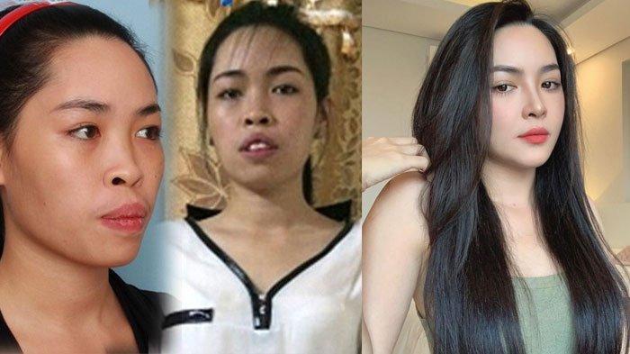 Bak Terlahir Kembali, Kisah Para Wanita Rubah Drastis Penampilan, Dulu Dihina Kini Dipuja ...