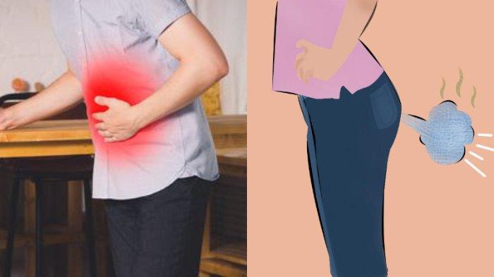 6 Gejala Penyakit Usus yang Harus Diwaspadai, dari Sembelit hingga ...