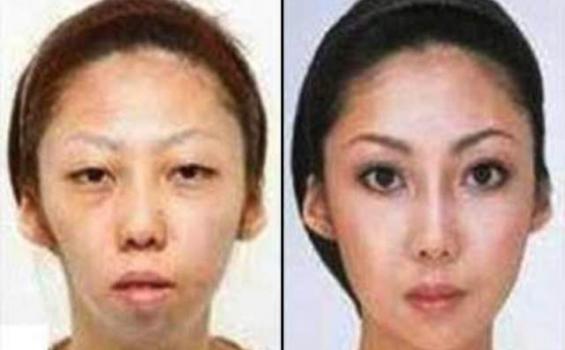 Suami Tuntut Istri karena Anak Buruk Rupa - TribunNews.com