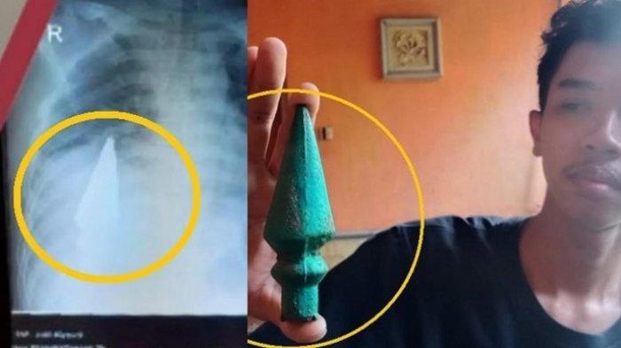 Dada Pria Ini Tertembus Besi Pagar, Terpeleset saat Bersihkan Tanaman ...