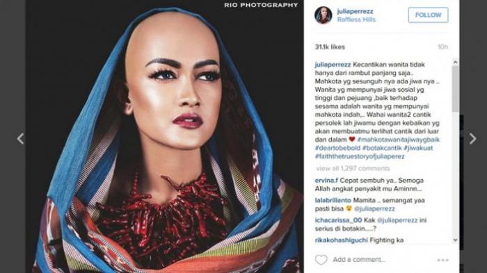 Unggah Foto Botak Plontos, Jupe Bicara Soal Mahkota Wanita yang ...