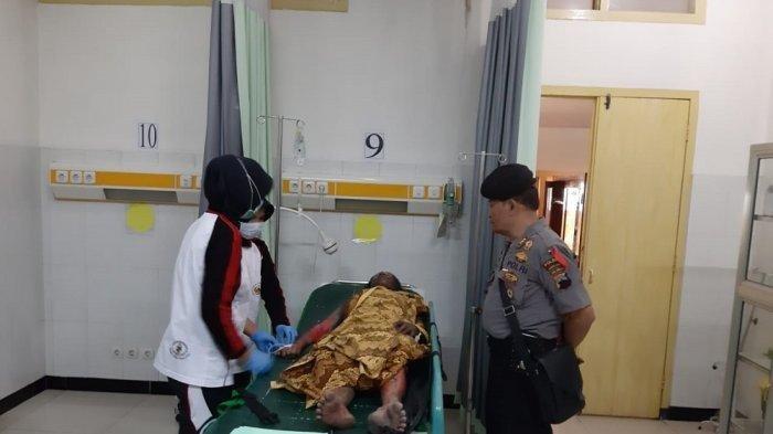 Coba Bunuh Diri, Miyati Siram Tubuhnya Dengan Bensin Lalu Membakar Diri ...