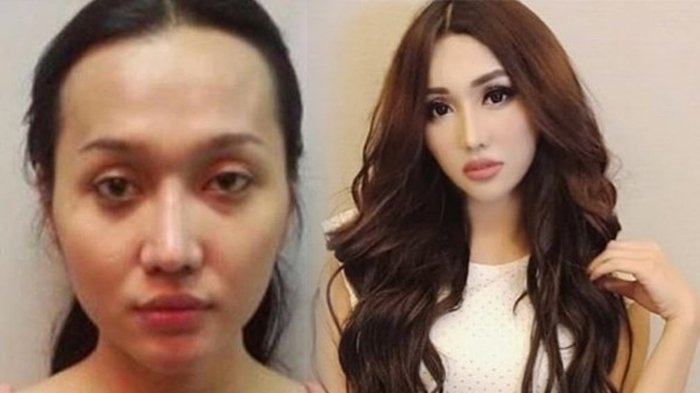 Terungkap, Di Negara Ini Lucinta Luna Lakukan Operasi Plastik, Biayanya ...