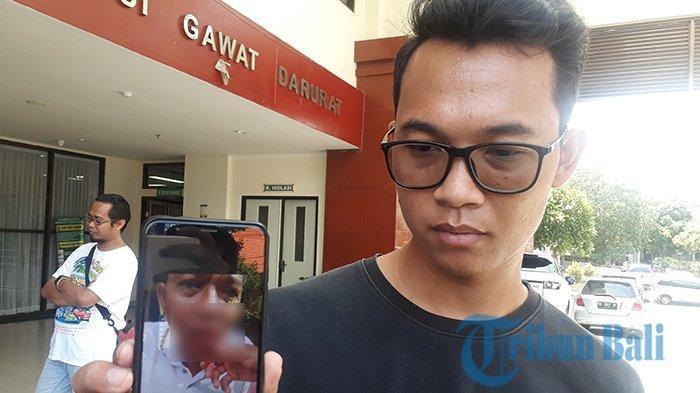 Mulut Ketut Ardika Melepuh Usai Konsumsi Minuman Kemasan - TribunNews.com