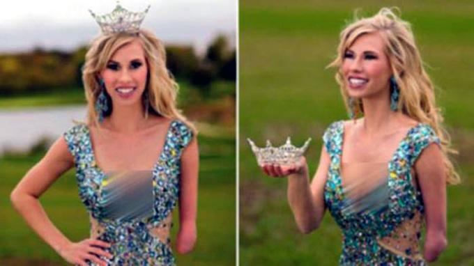 Nicole Kelly, Miss Iowa 2014 yang Hanya Punya Satu Tangan - TribunNews.com