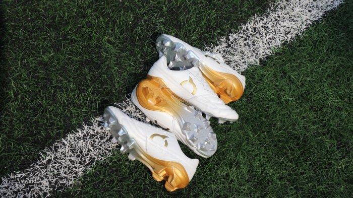 Punya Struktur Serat Lebih Kuat, Kulit Kanguru Makin Dilirik Jadi ...